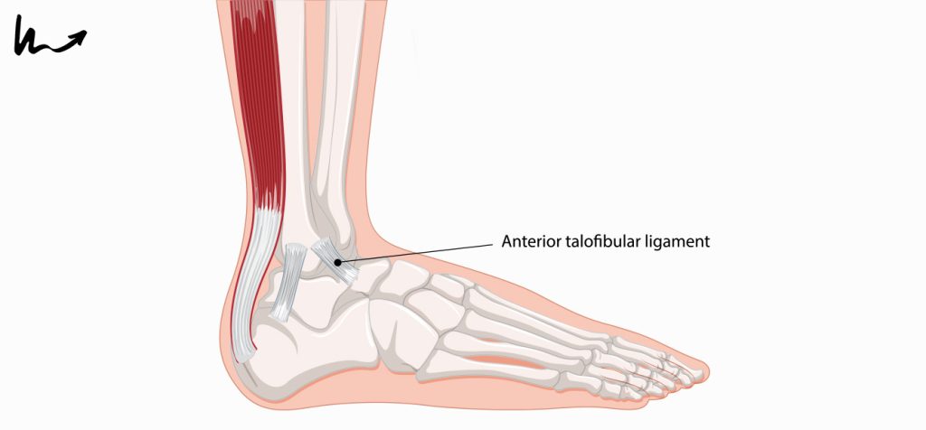 Ankle Ligament Tear Healing Time | The Movement Laboratory